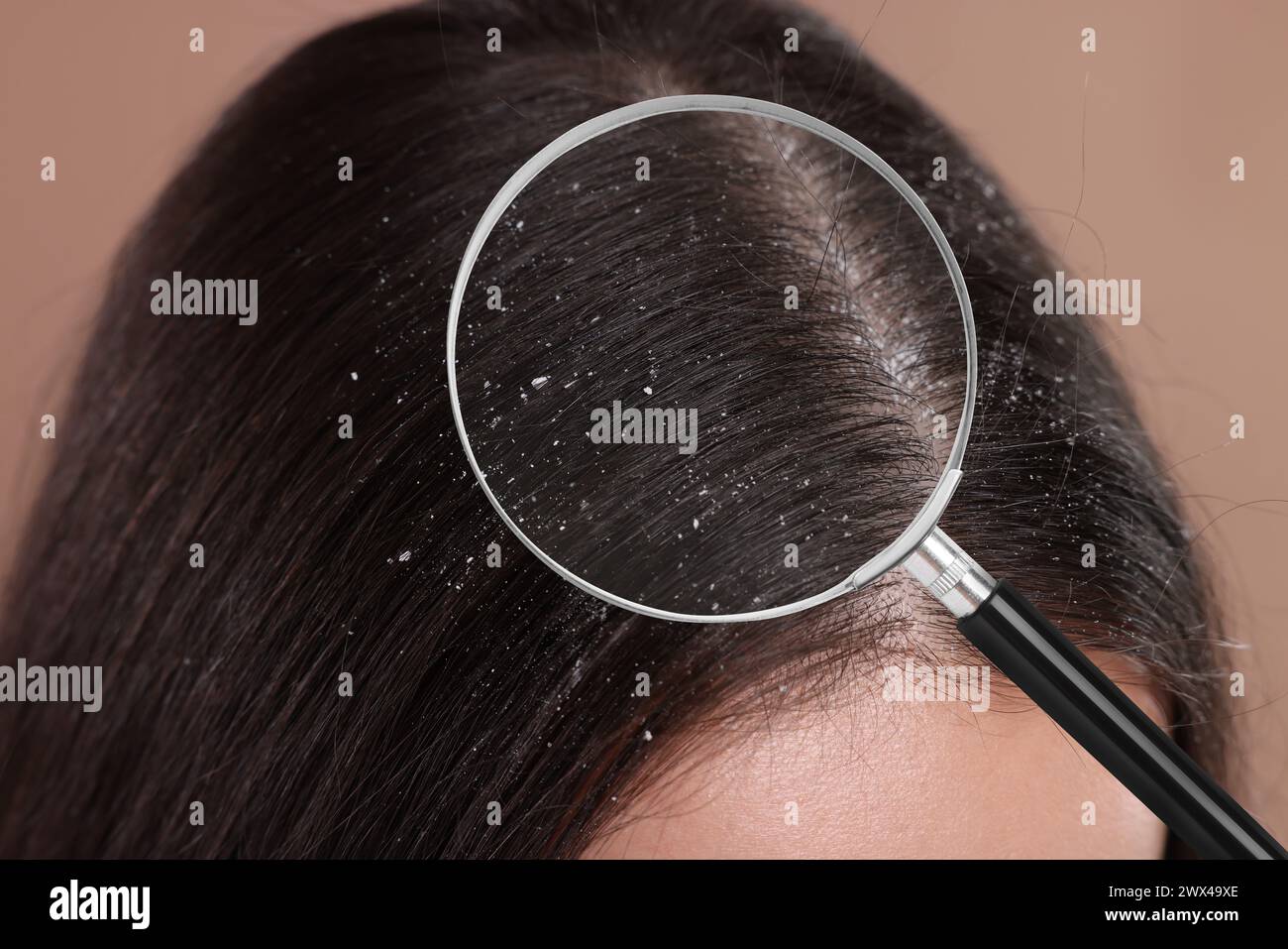 Woman suffering from dandruff on pale brown background, closeup. View ...