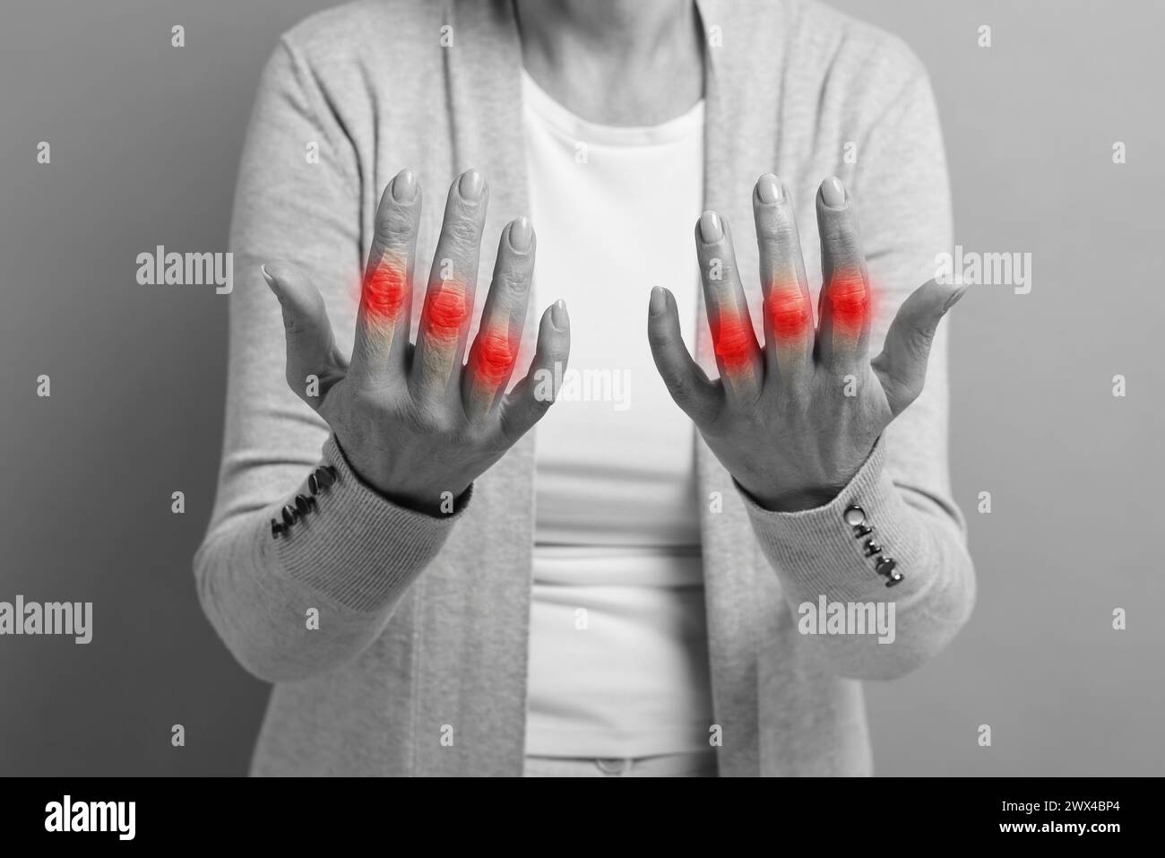 Arthritis symptoms. Woman suffering from pain in her fingers on ...