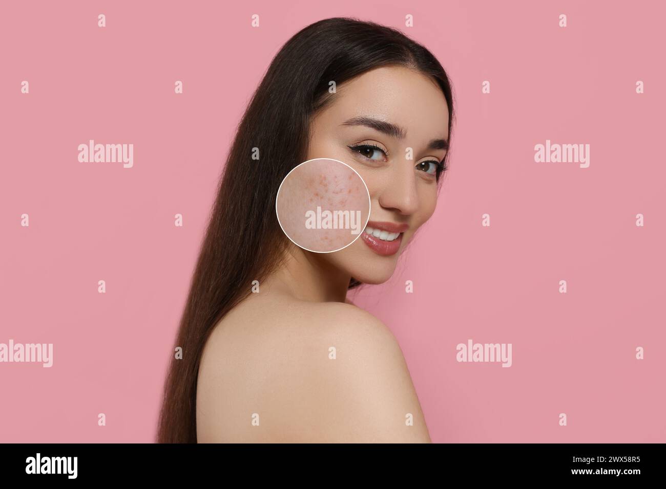 Woman skin rash happy hi-res stock photography and images - Alamy
