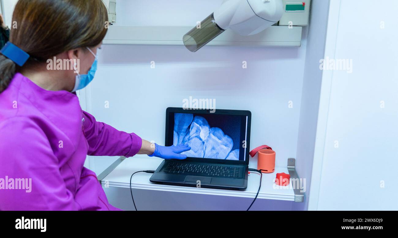 Female dentist looking at an x-ray on the computer in a dental clinic ...