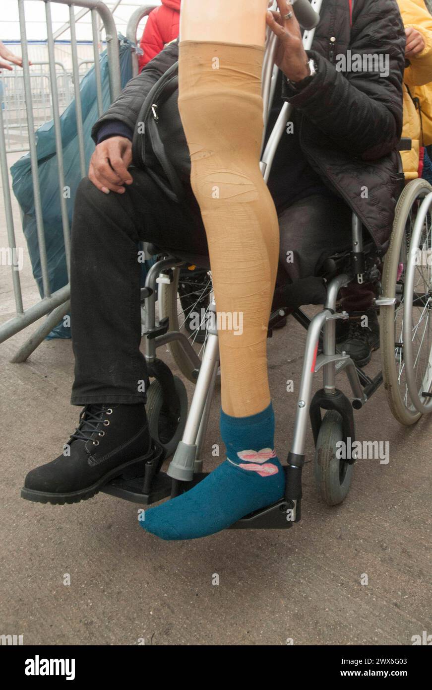 Disability in its various forms as a sign of permanent and serious ...