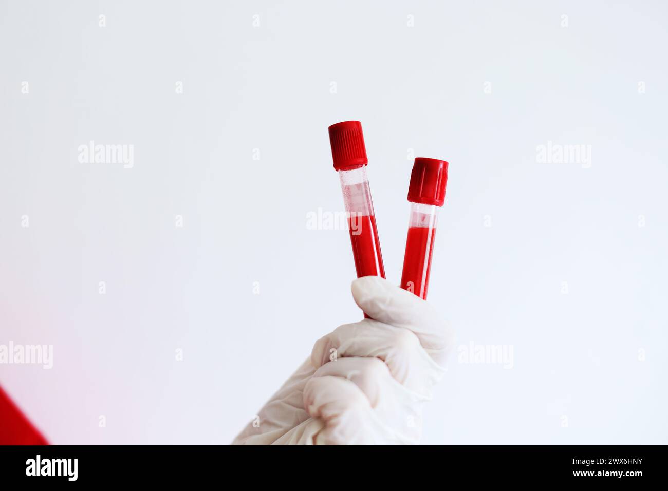 Arterial blood sample hi-res stock photography and images - Alamy
