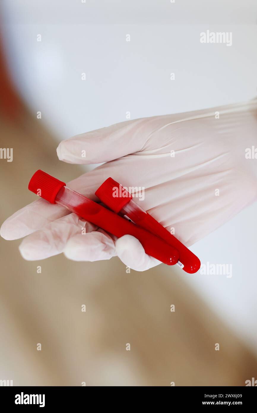 Hand with latex glove holding blood sample vial in front of blood test ...