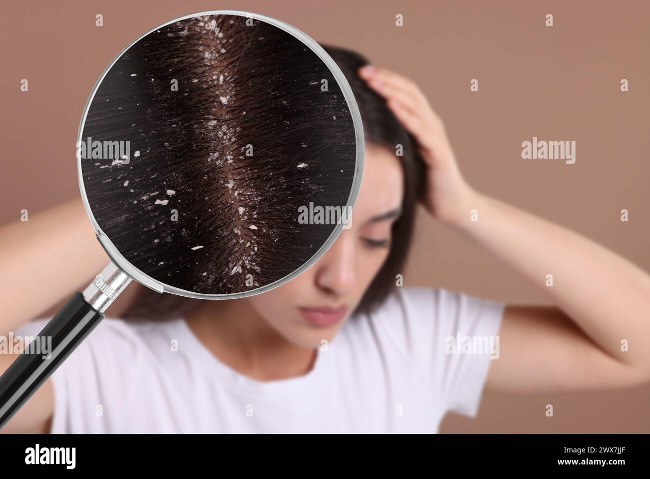 Woman suffering from dandruff on pale brown background. View through ...