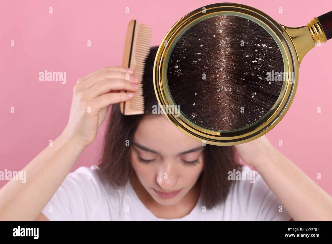 Woman suffering from dandruff on pink background. View through ...