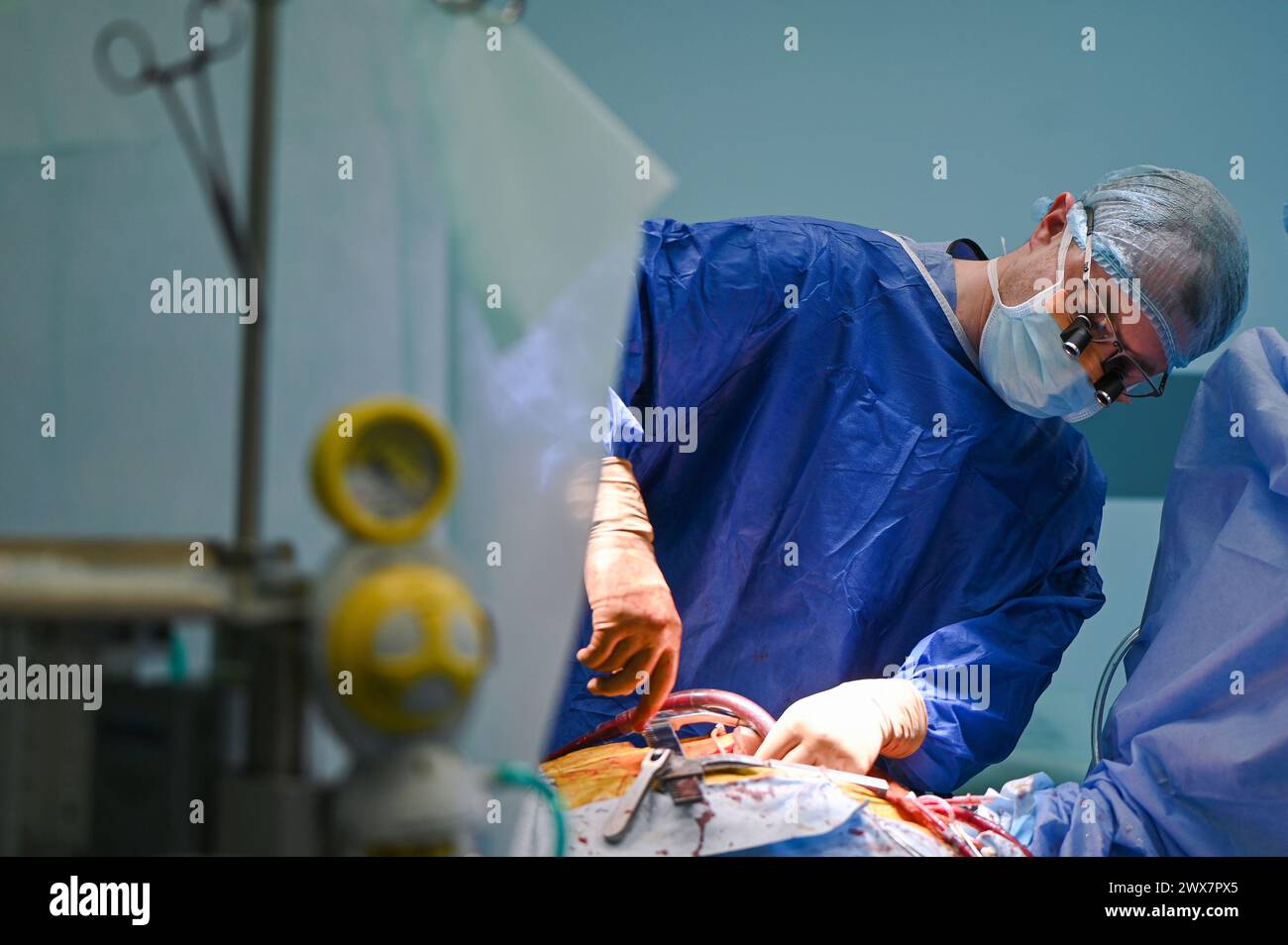 Non Exclusive: LVIV, UKRAINE - MARCH 27, 2024 - Cardiac surgeons of St ...