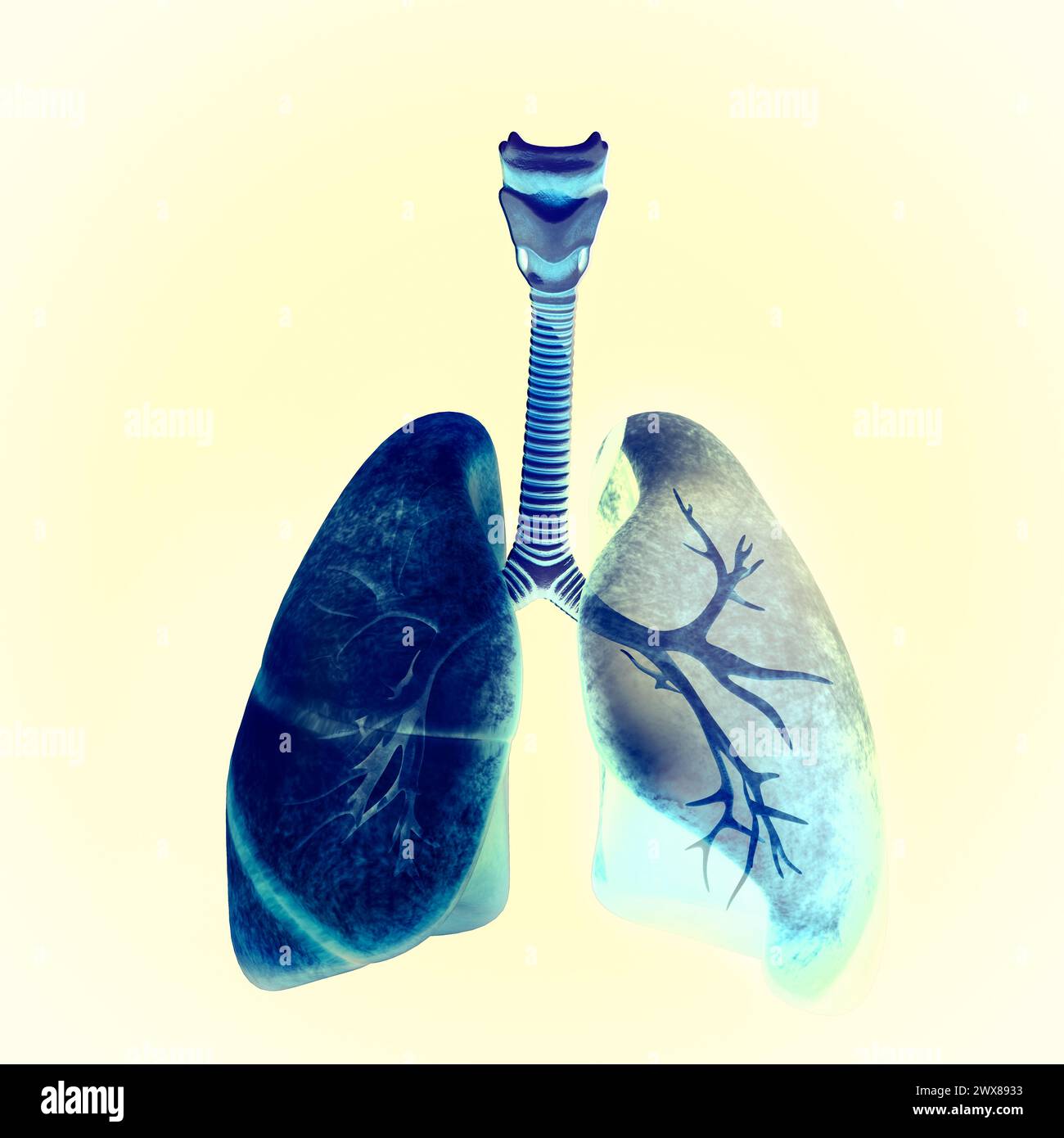 X-ray view of lungs and trachea, lung infection. Pneumonia. 3d ...