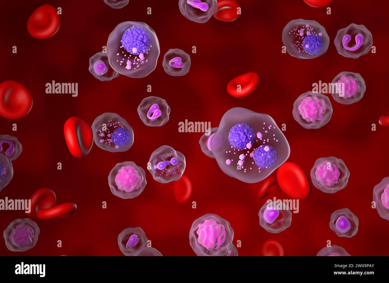 Multiple myeloma car t cell hi-res stock photography and images - Alamy