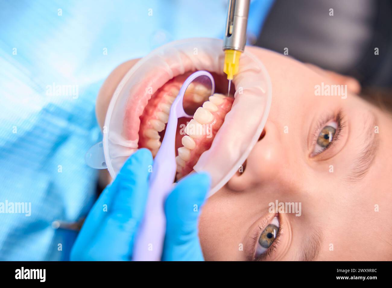 Doctor gives injection of anesthesia in gum of teenage girl Stock Photo ...