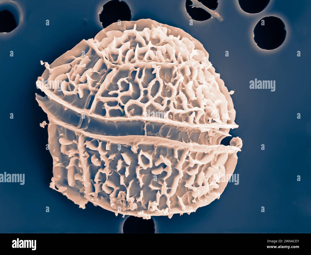 dinoflagellate algae photographed with an electron microscope on a blue ...