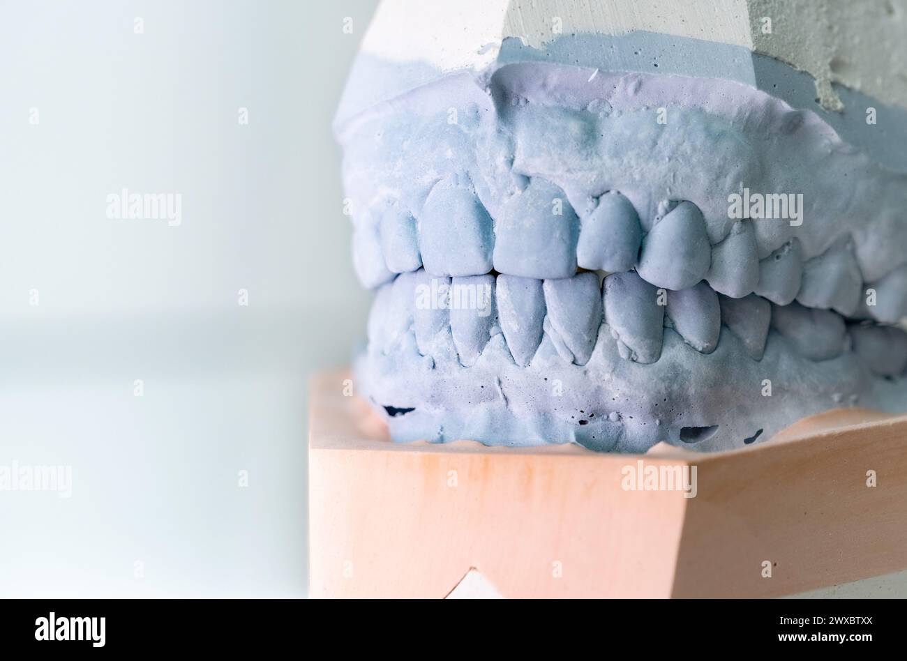 Detail of a model of a complete denture made of plaster for dental ...
