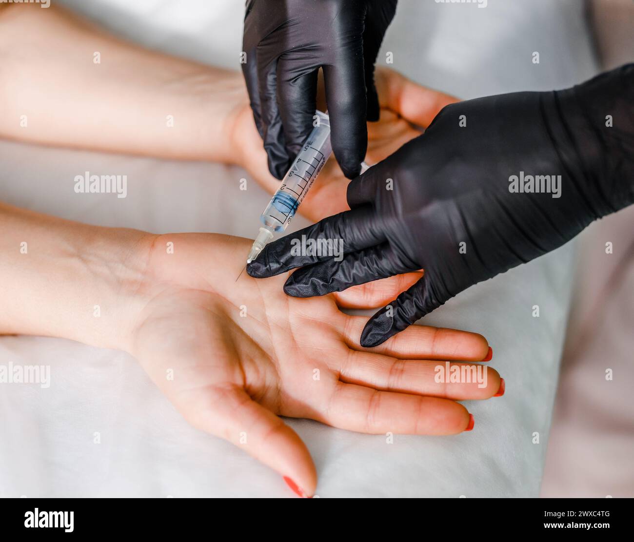 Injections into women's palms in a modern beauty salon. The concept of ...