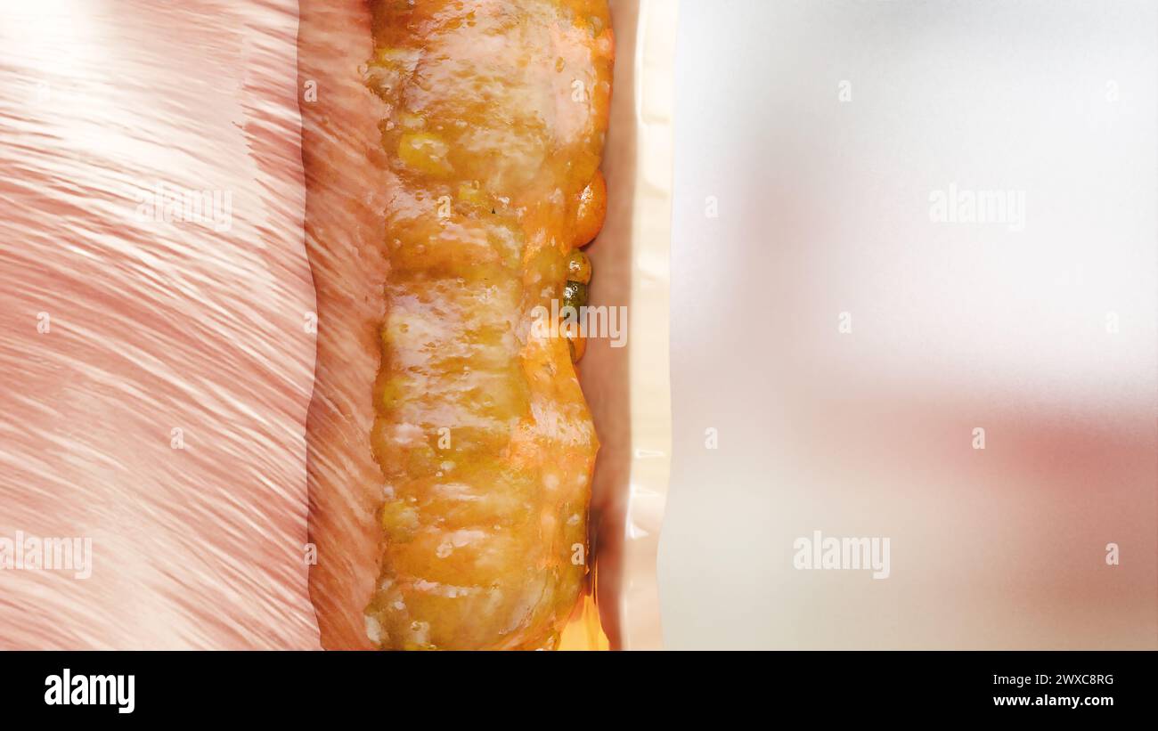 Weight loss Comparison. man body transformation. Before and after a ...