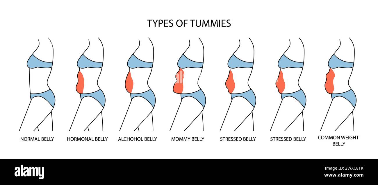 Types of tummies vector doodle set Stock Vector Image & Art - Alamy