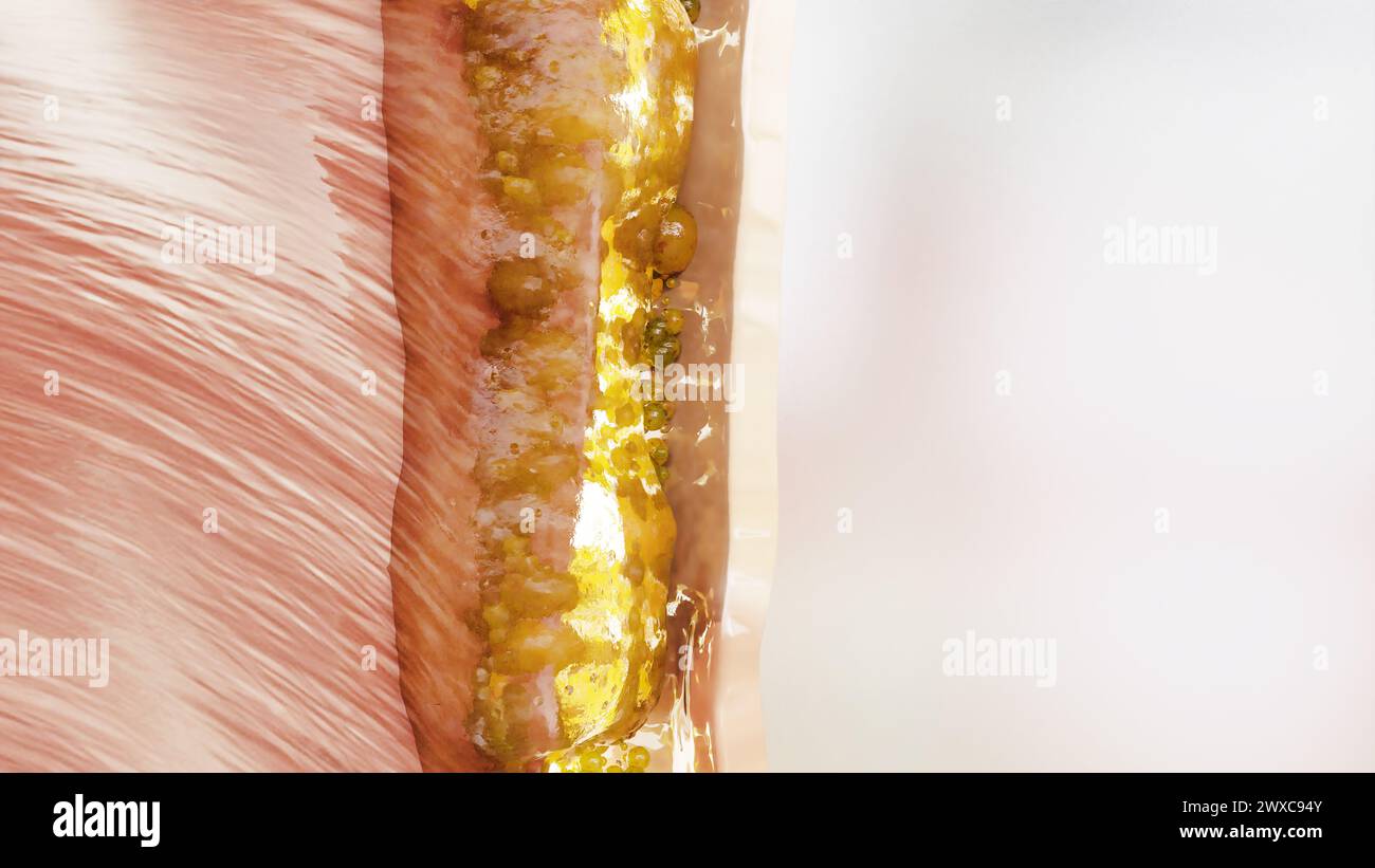 Weight loss Comparison. man body transformation. Before and after a ...