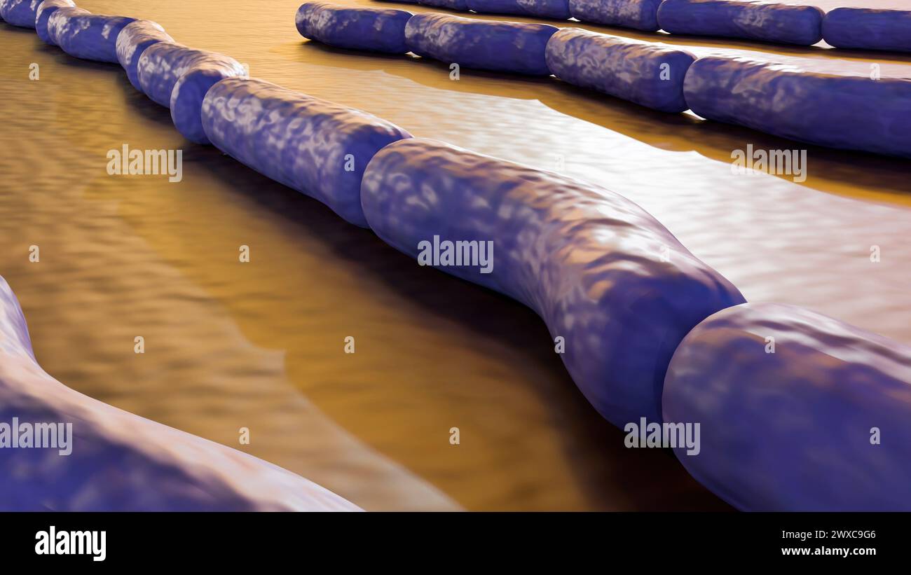 Anthrax is a fatal bacterial disease caused by the Bacillus anthracis ...