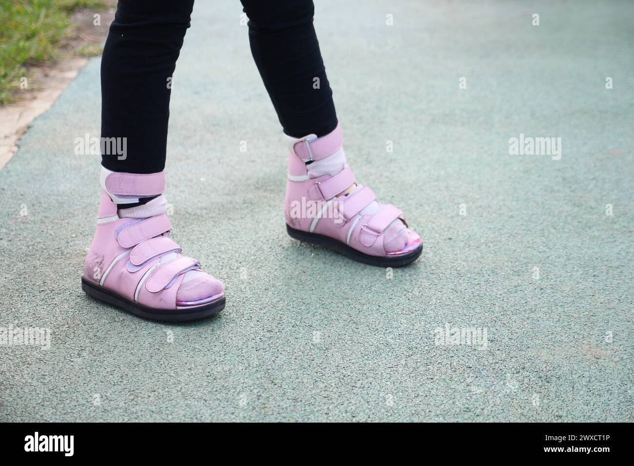 Child cerebral palsy disability, legs orthosis Stock Photo - Alamy