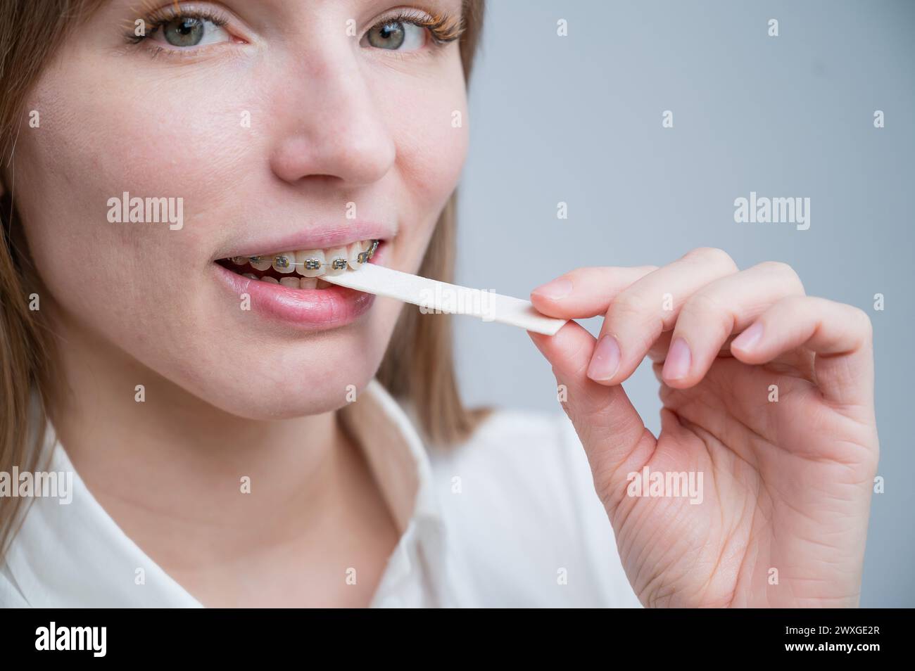 Young woman with metal braces on her teeth is chewing gum. The girl is ...