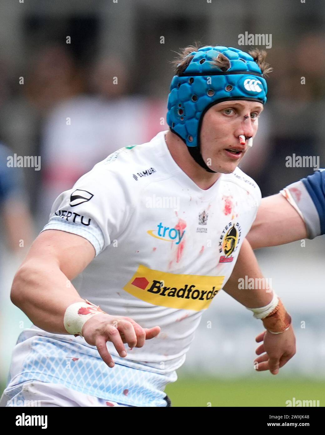 Ross Vintcent of Exeter Chiefs played on with a damaged nose during the ...