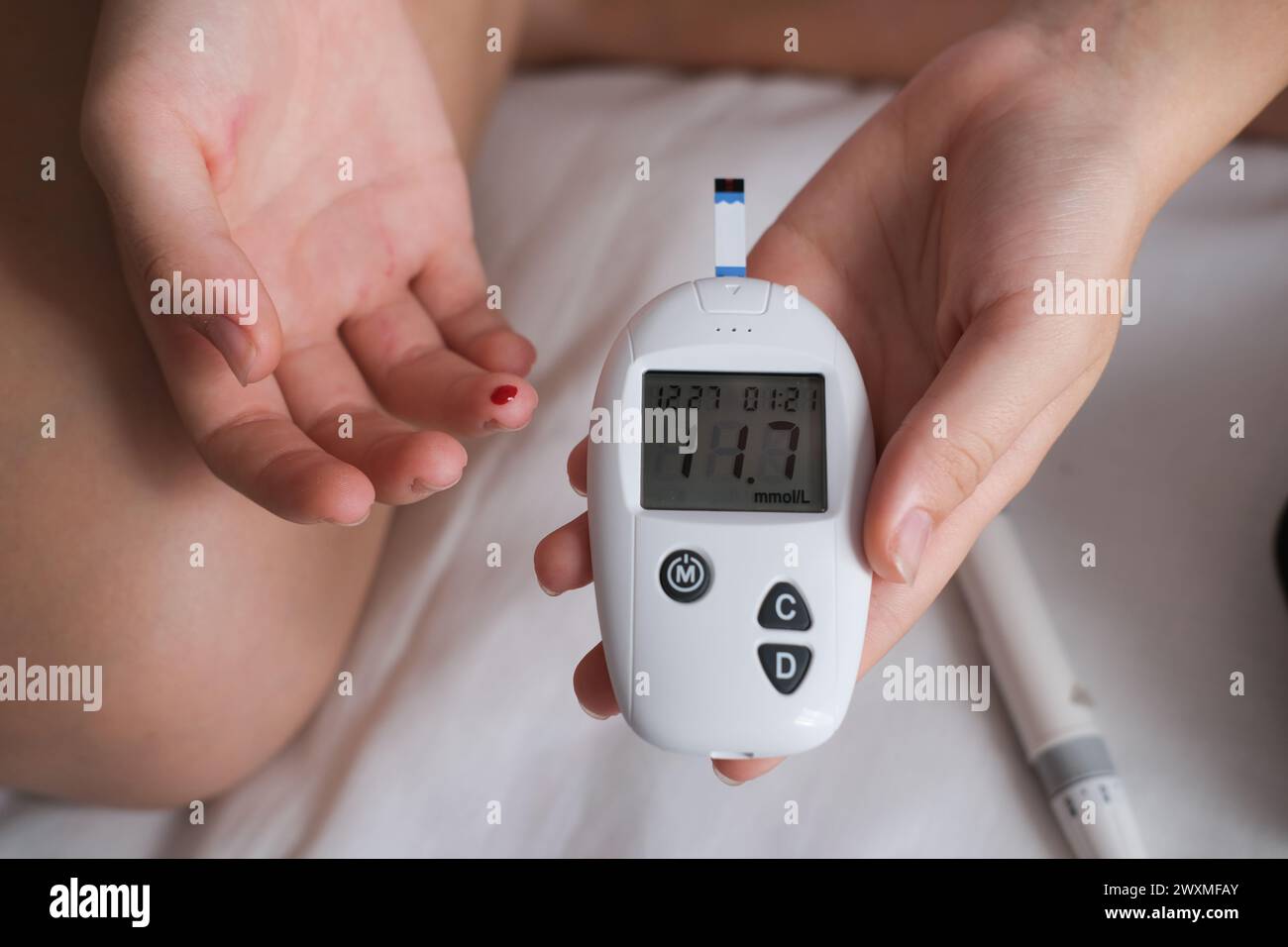 Diabetes test. Child hands checking blood sugar level by Glucose meter ...