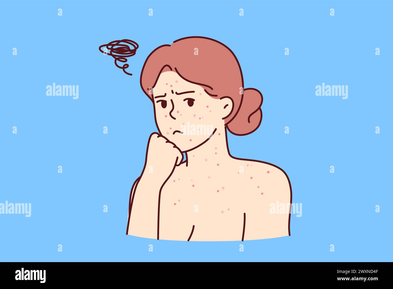 Woman with allergic rash on face and body looks sadly at screen ...