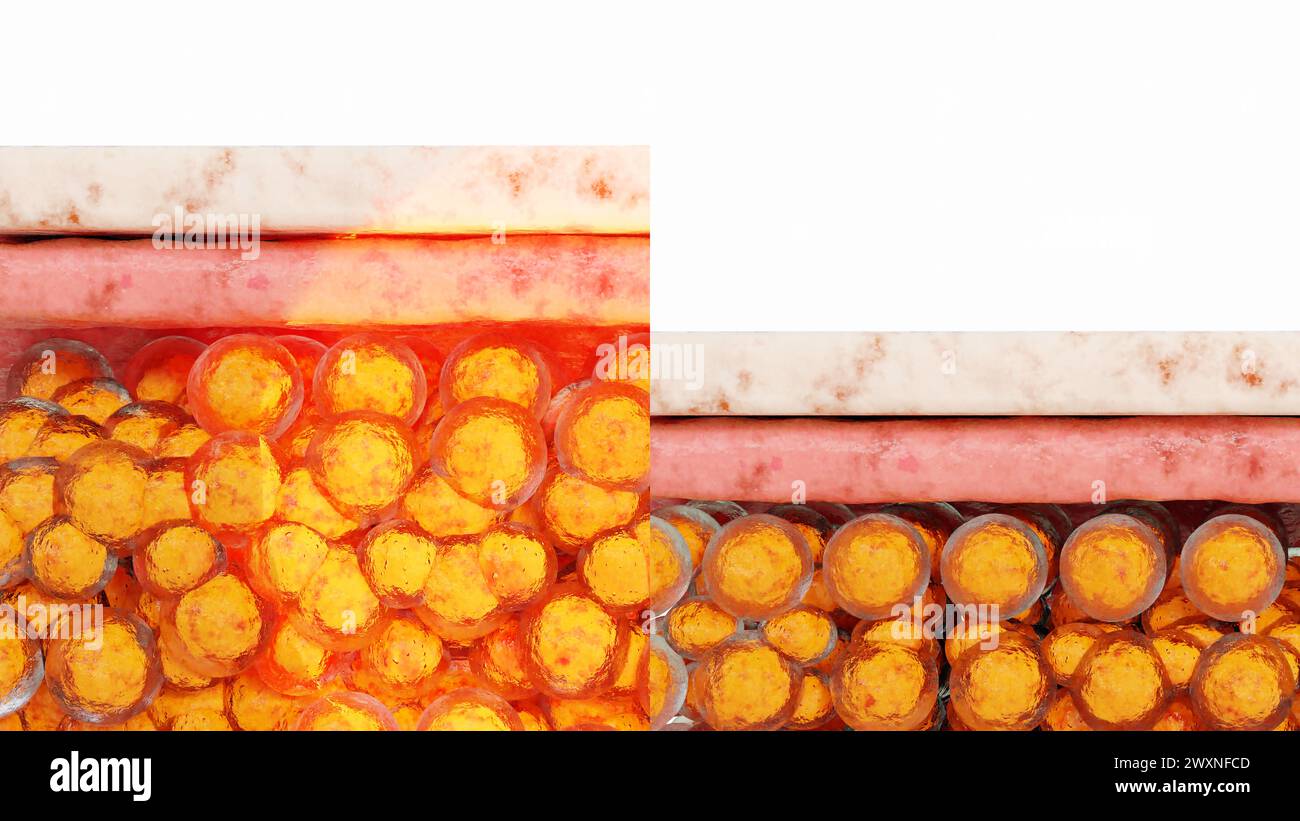 Weight loss Comparison. man body transformation. Before and after a ...