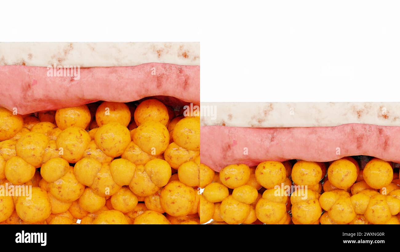 Weight loss Comparison. man body transformation. Before and after a ...