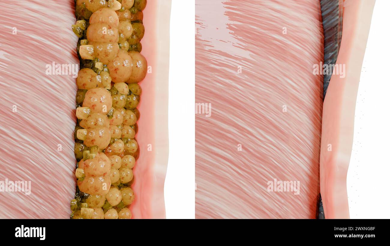 Weight loss Comparison. man body transformation. Before and after a ...