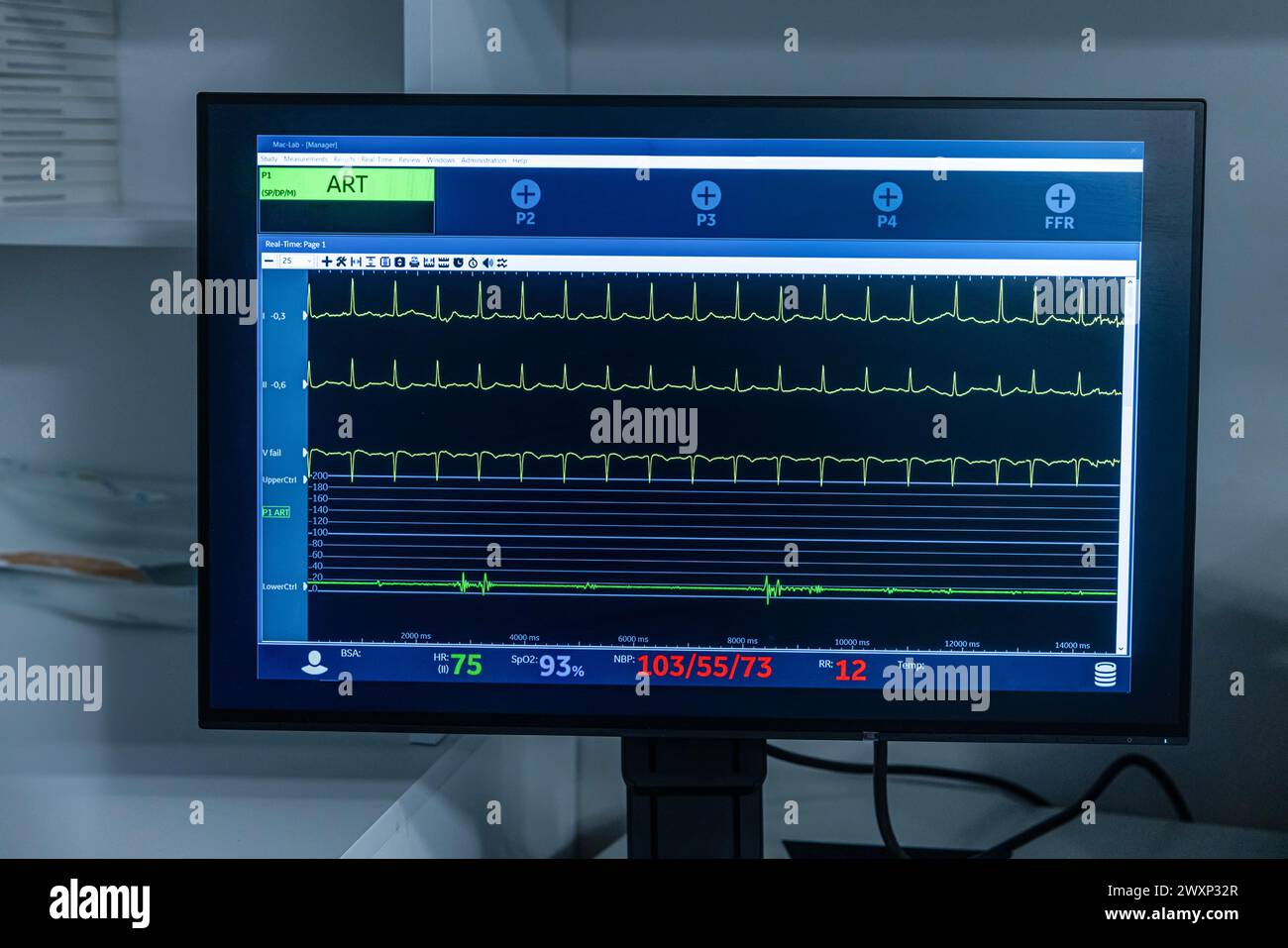 Modern equipment with vital signs monitors in operating room of ...