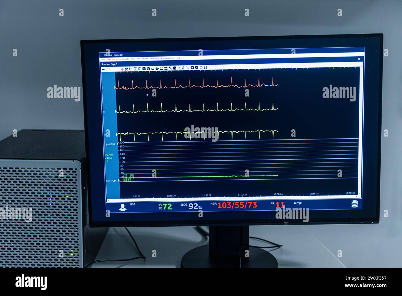 Modern equipment with vital signs monitors in operating room of ...
