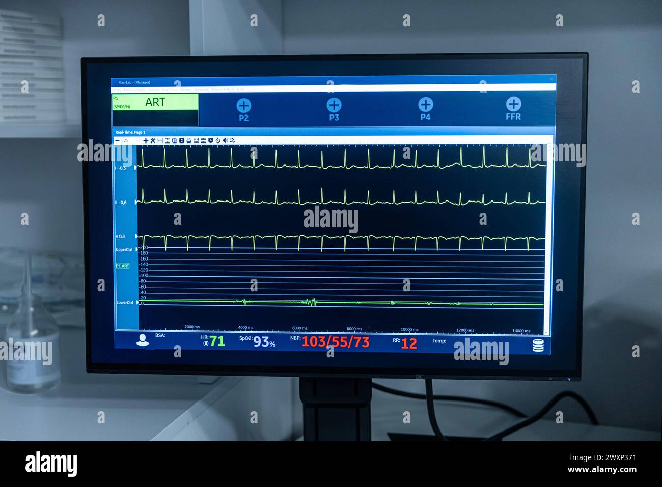 Modern equipment with vital signs monitors in operating room of ...