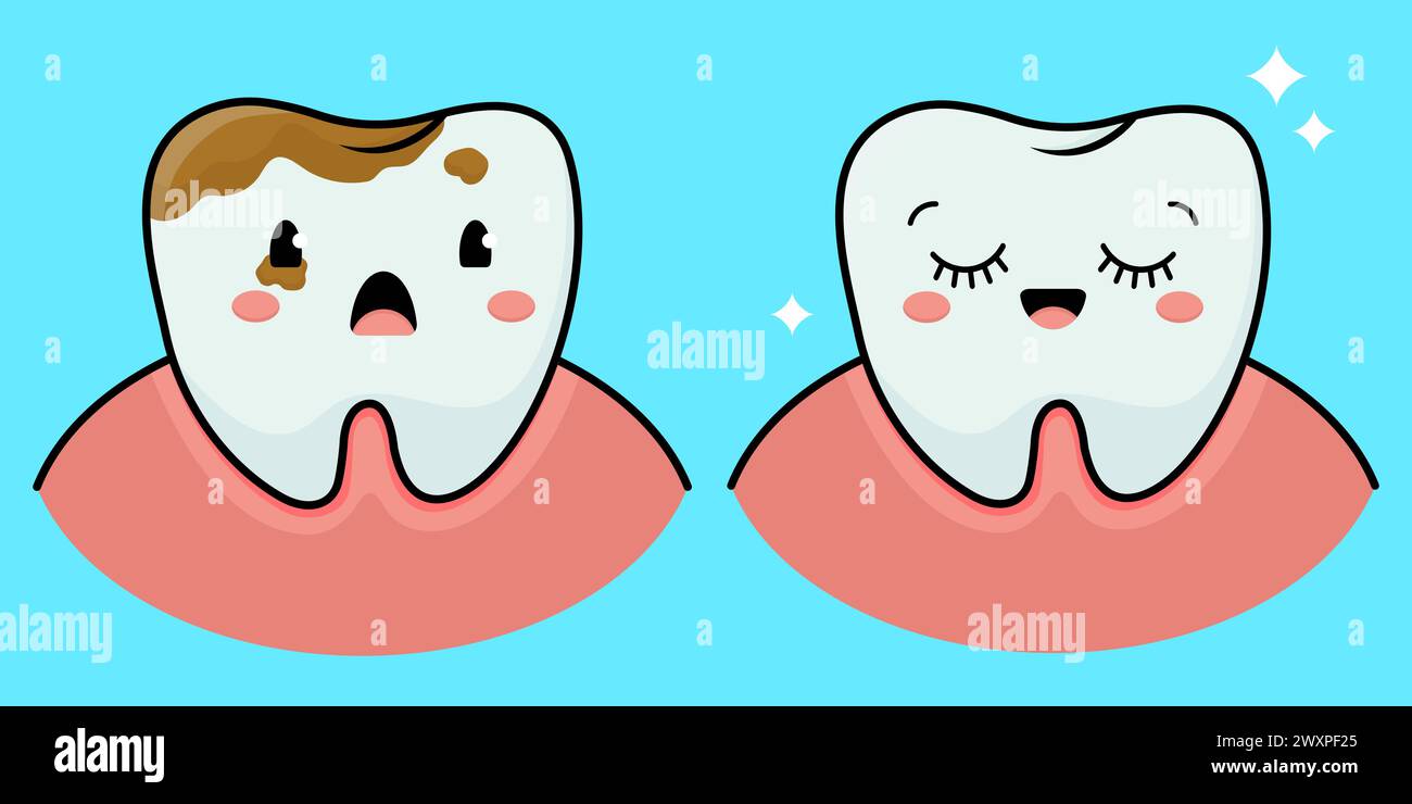 Two teeth, a diseased tooth and a healthy tooth. Vector illustration ...