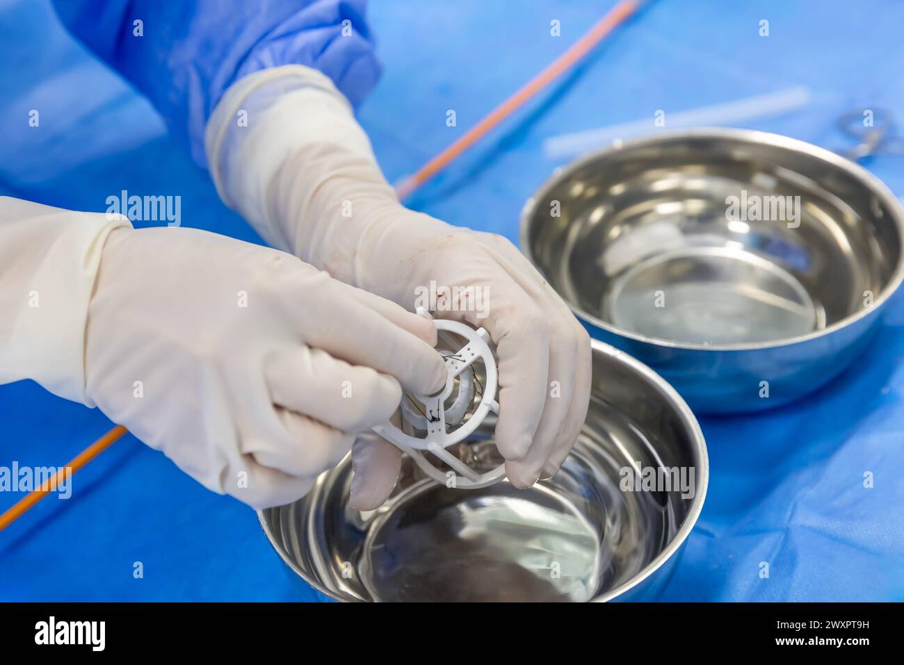 Heart valve surgery cardiology for patient in hospital. Prepare ...