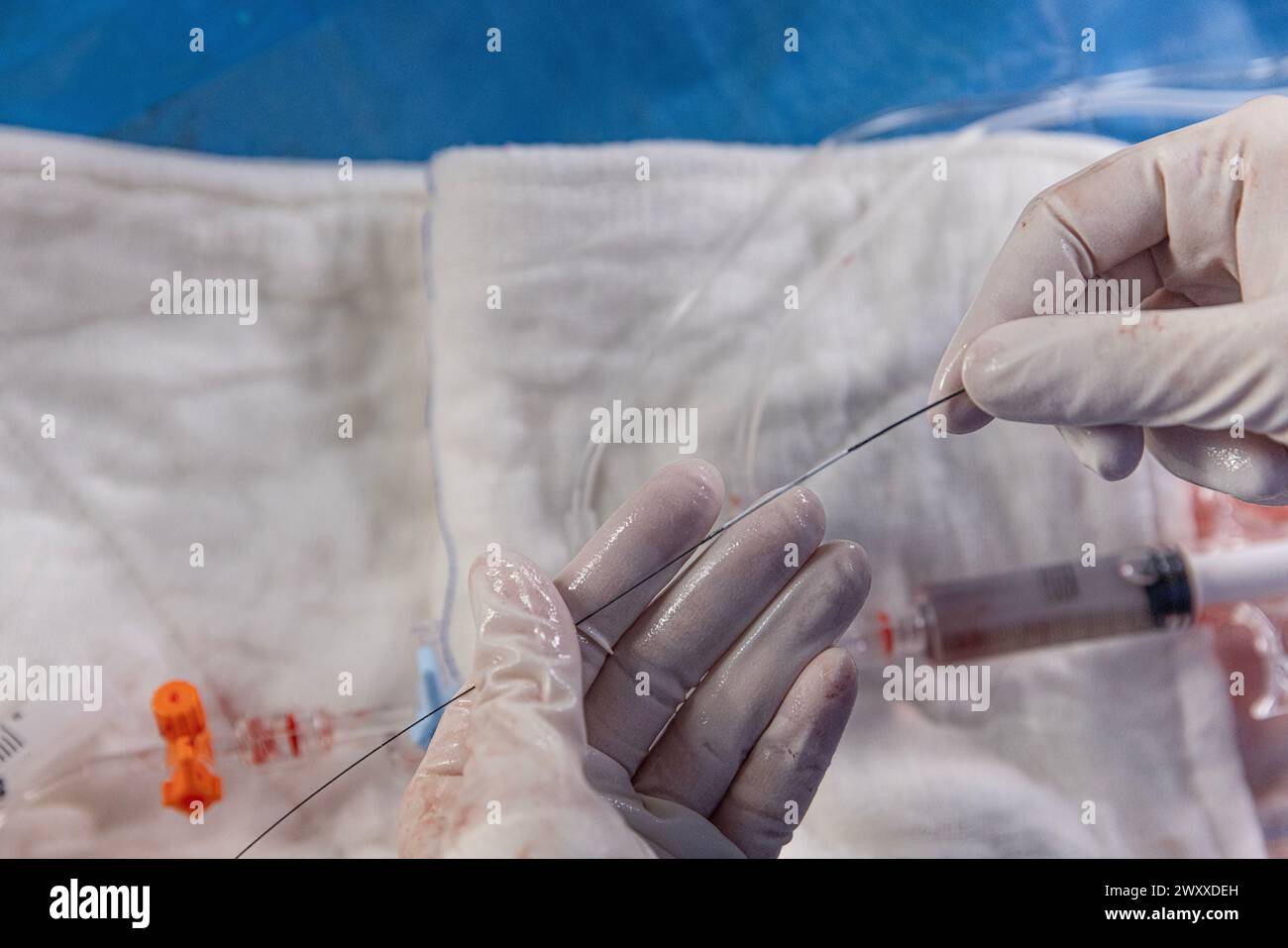 Interventional cardiology. Surgeon doctor at operation. Stent and ...