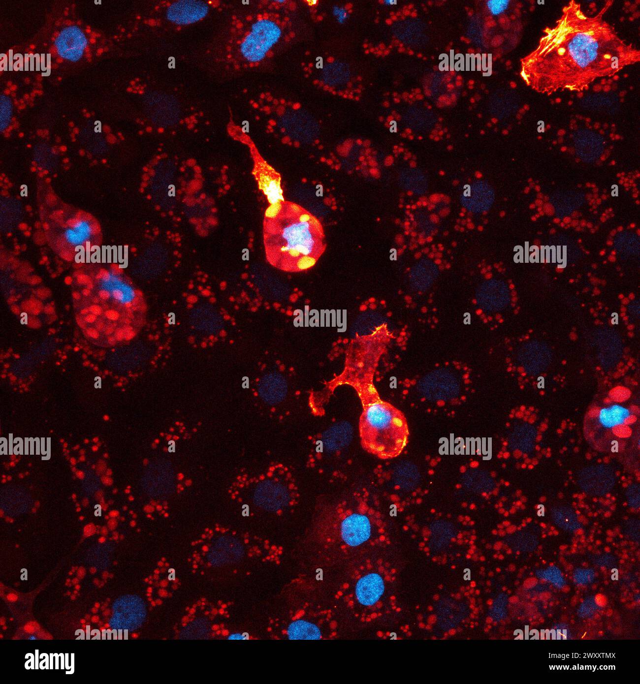 Confocal light micrograph of two macrophages in the precursor to skin ...