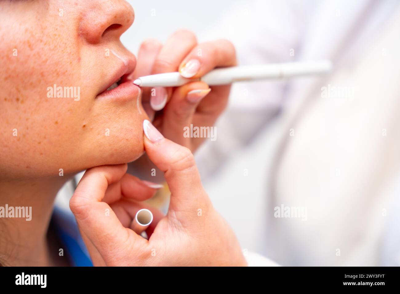 Aesthetic doctor marking the points of the lips to inject with ...