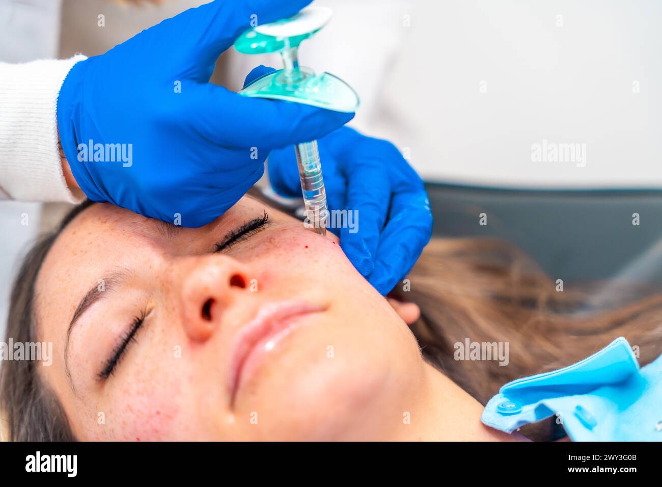Doctor injecting hyaluronic acid injection to the face of a woman ...