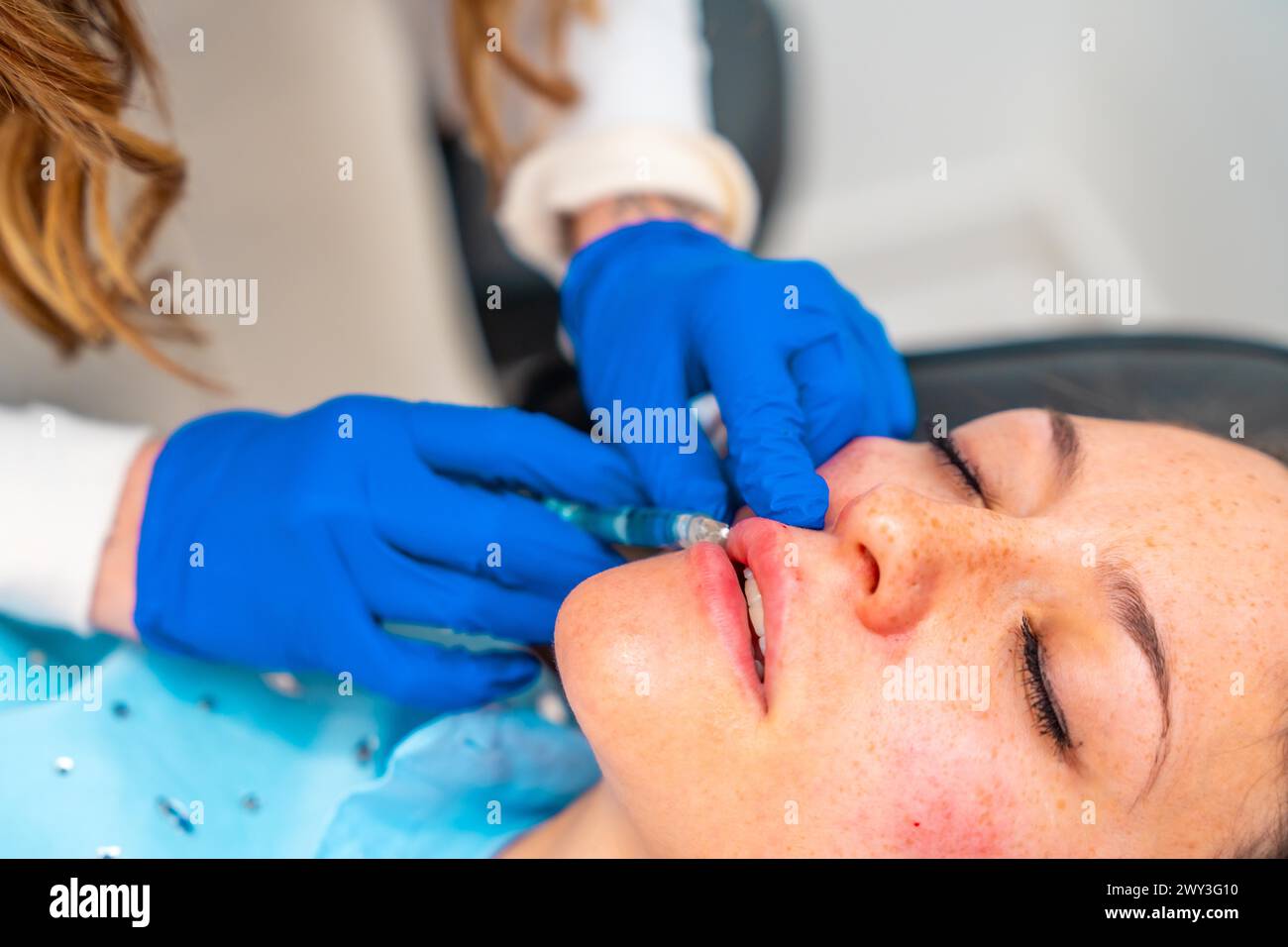 Woman receiving an injection to increase volume in the lips in a facial ...