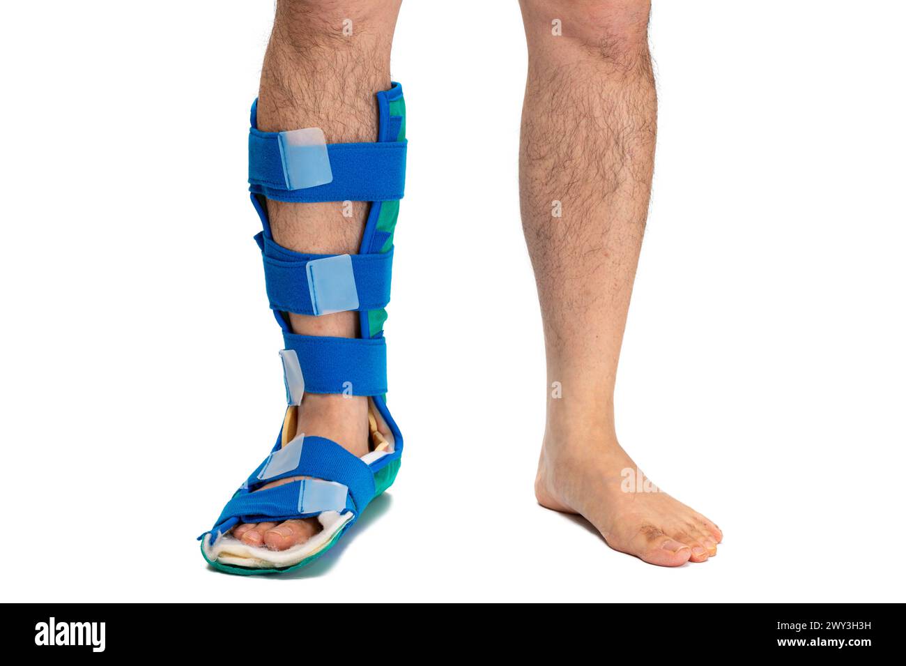 Orthopedic cast Cut Out Stock Images & Pictures - Alamy