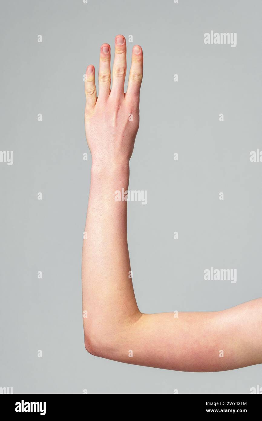 Extension of forearm hi-res stock photography and images - Alamy