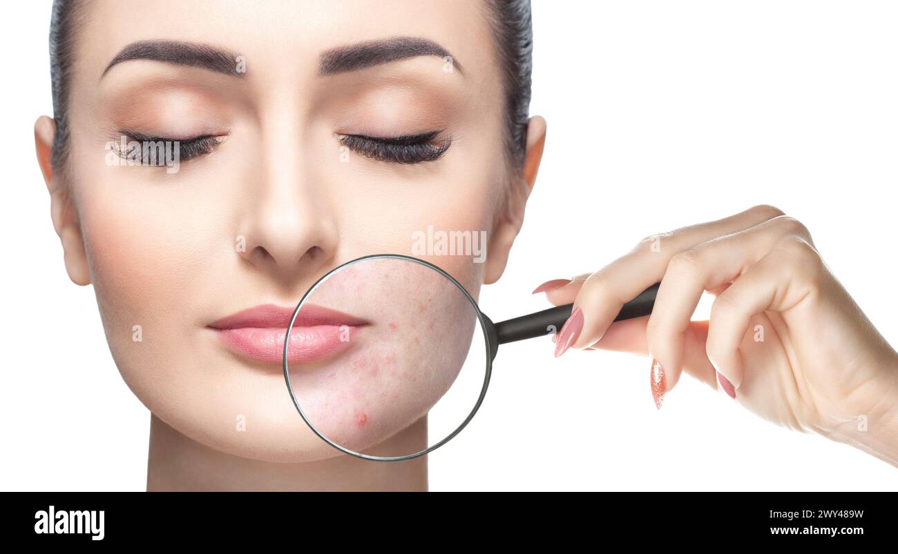 A woman holds a magnifying glass near the face and shows the problem ...