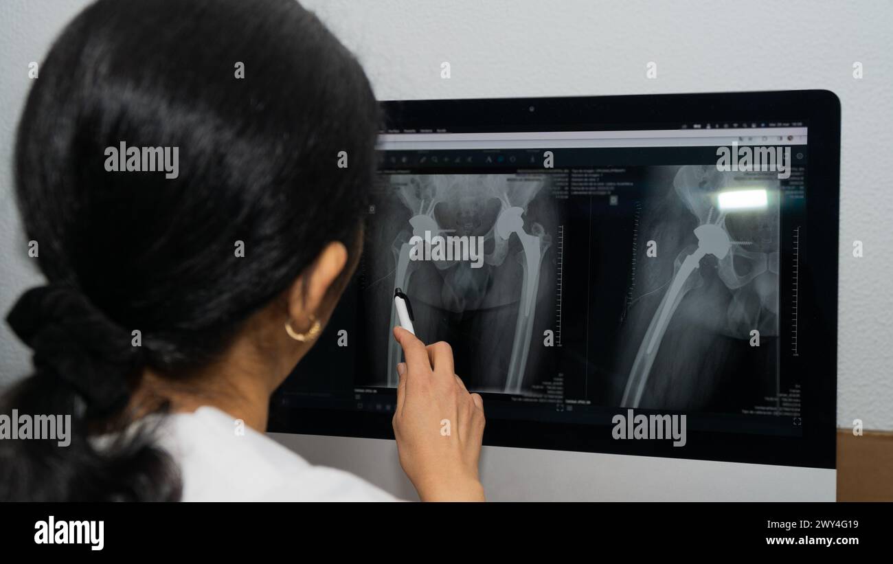 A woman is looking at a computer monitor with a picture of a leg on it ...