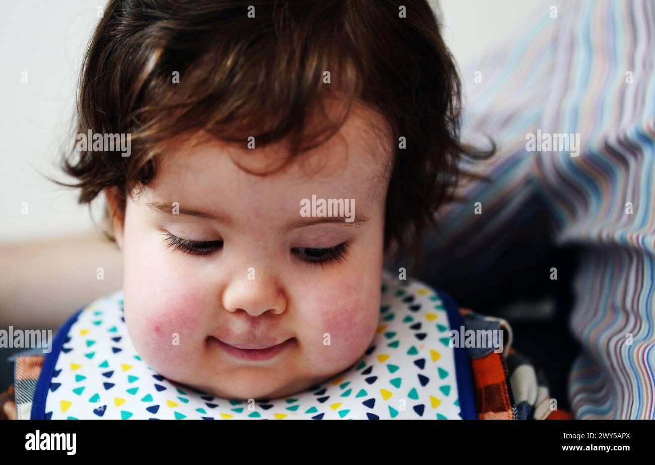 Two-year-old Sean Daly, who was diagnosed with an extremely rare ...
