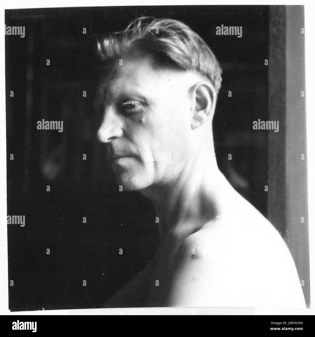 Emile Renard, Belgian Police Inspector, bears scars including a ...