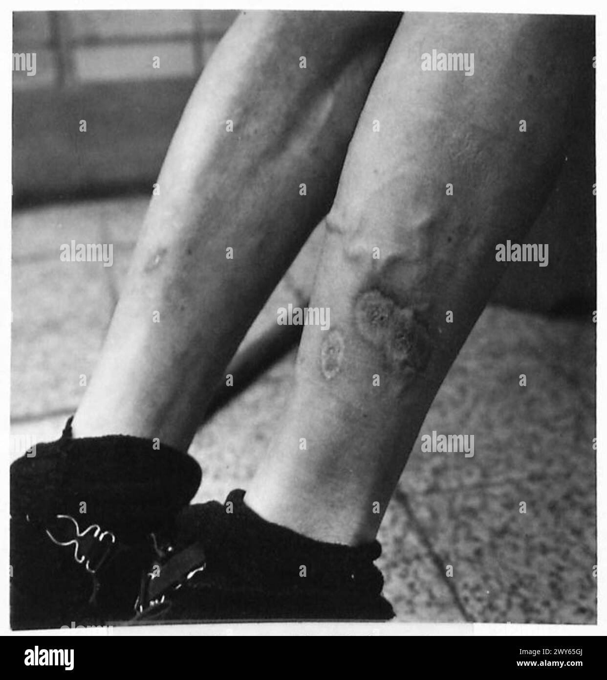 GERMAN ATROCITIES AND TORTURE AGAINST THE BELGIAN PEOPLE. - The scar of ...