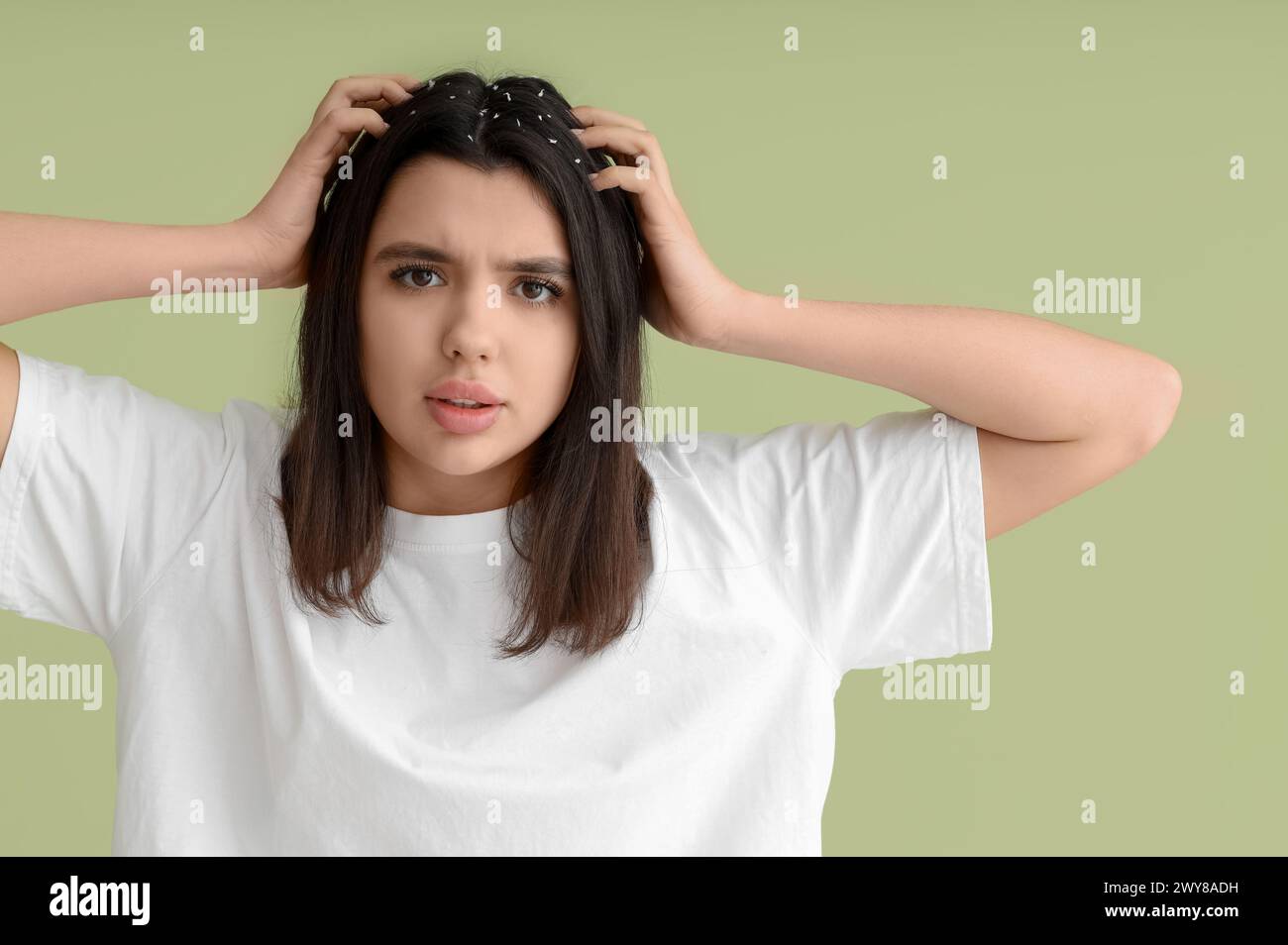Young woman with dandruff problem scratching head on green background ...