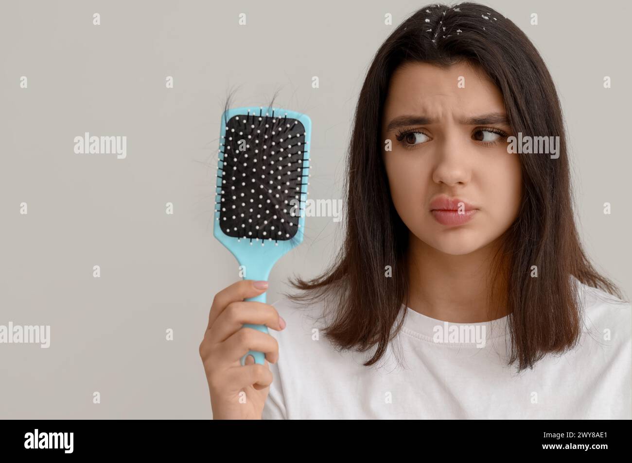 Worried young woman with hair loss problem on white background Stock ...