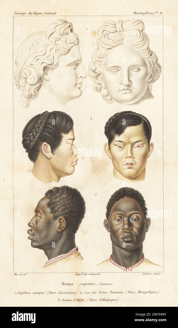 Heads of Homo sapiens: Greek god Apollo 1, one of the Siamese Twins ...