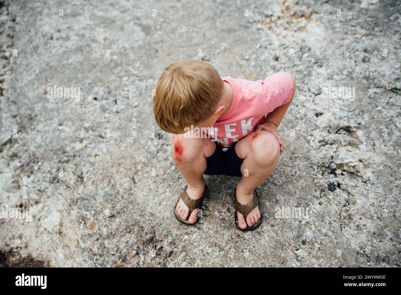 Overhead view of little boy looking at skinned knee in summer Stock Photo - Alamy