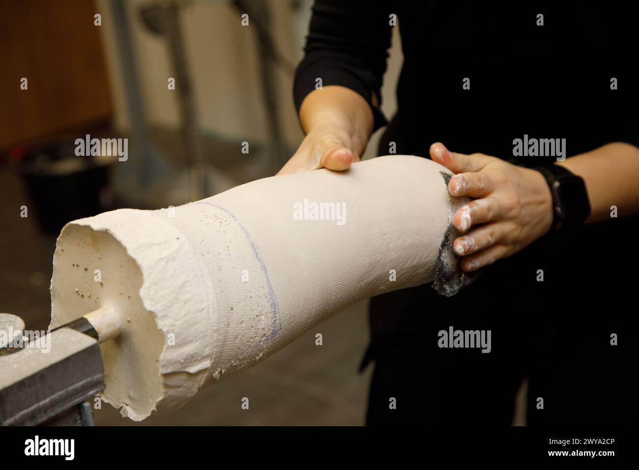 KYIV, UKRAINE - APRIL 04, 2024 - The process of making a lower limb prosthesis in the shop of ...